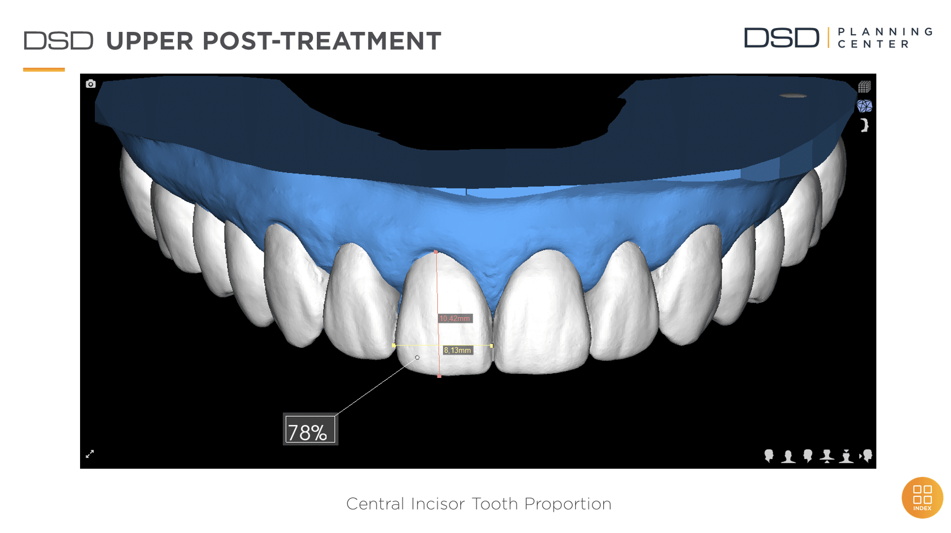 About Your First Visit at Heritage Dentistry